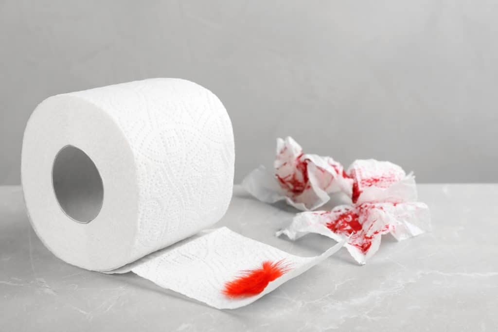 What Is Rectal Bleeding ICD 10 What Is Rectal Bleeding ICD 10