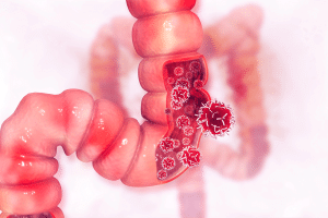 Your Colonoscopy Guide: How To Prepare & What To Expect